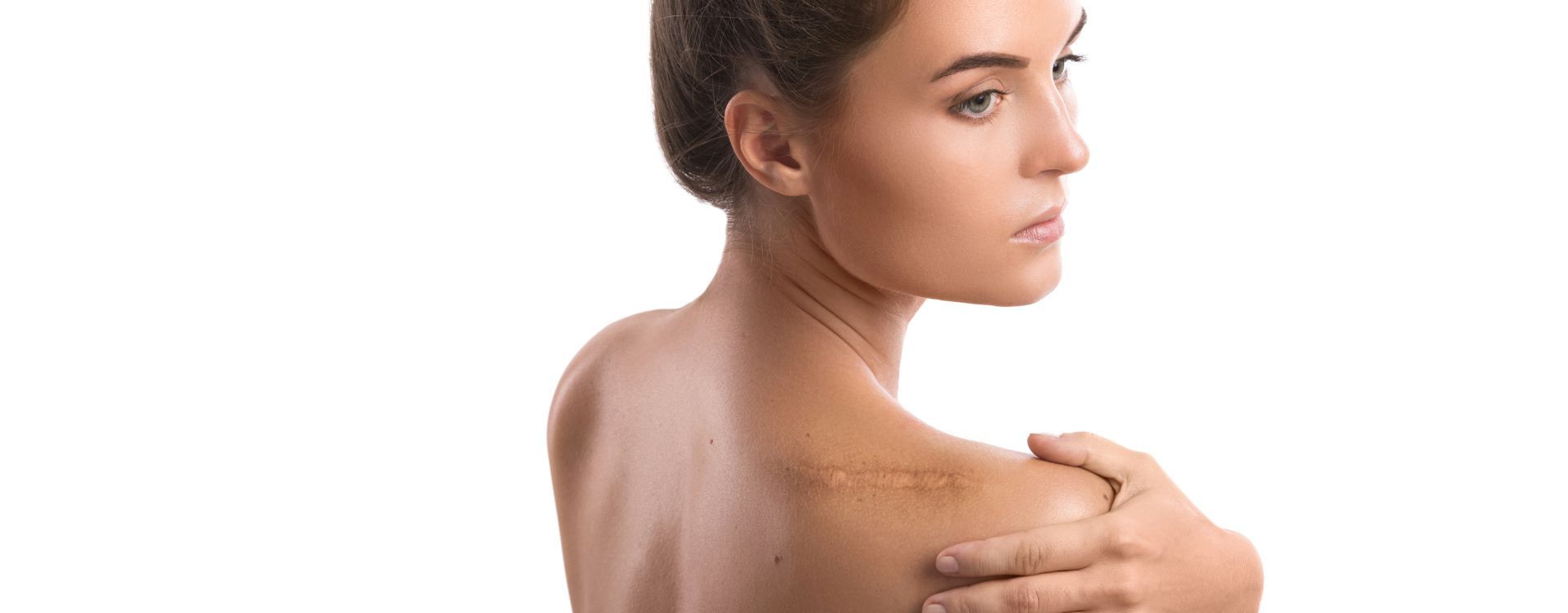 Scarring | Scar Treatment | PHI Clinic London